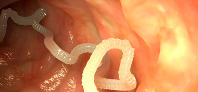 Mensch erleidet Krebs durch Bandwurm