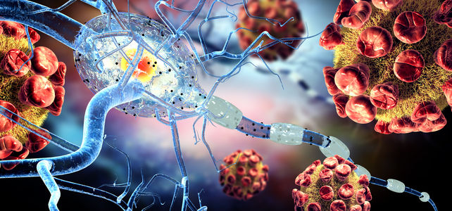Die Voxel-Guided Morphometry (VGM) des Gehirns bei Multipler Sklerose - Teil zwei